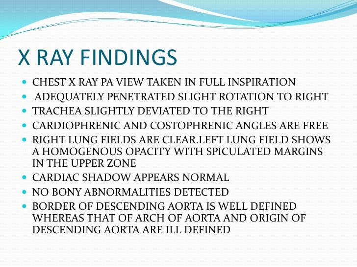 X Ray: Chest-Homogenous opacity