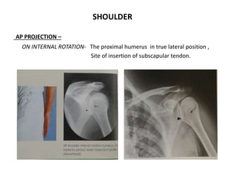 Xray ortho | PPTX