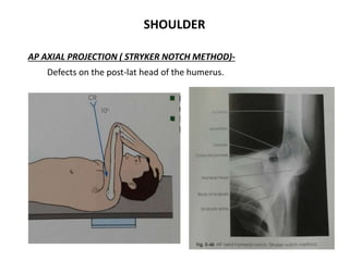 Xray ortho | PPTX