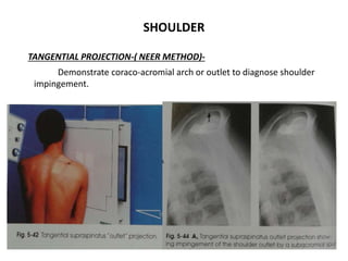 Xray ortho | PPTX
