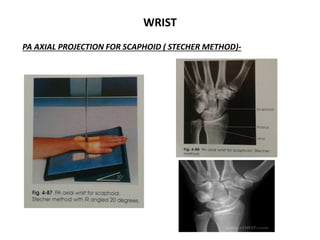 Xray ortho | PPTX