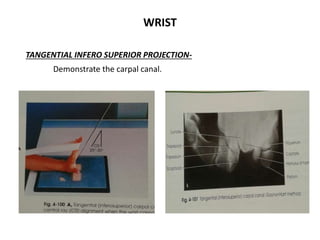 Xray ortho | PPTX
