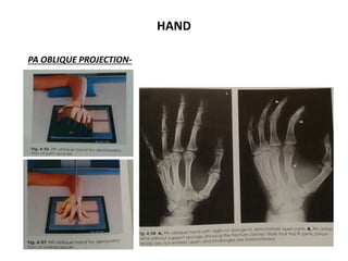 Xray ortho | PPTX