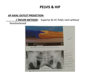 Xray ortho | PPTX