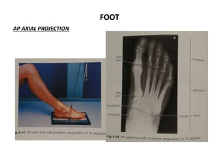 Xray ortho | PPTX