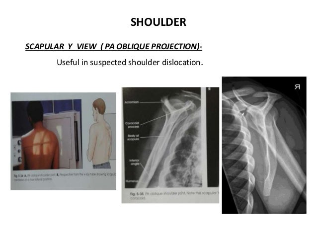 Outlet Projection View Shoulder | semashow.com