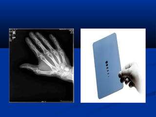X ray physics | PPT