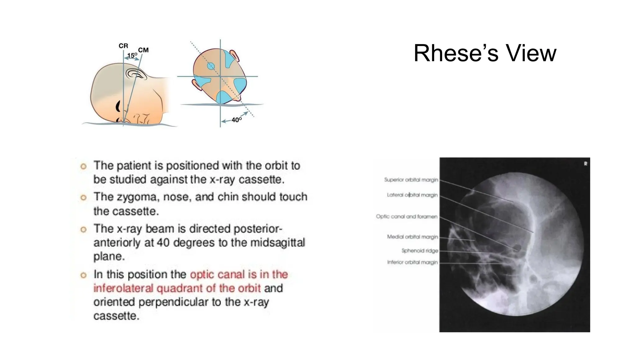 X ray Paranasal sinuses? PNS............ | PPTX