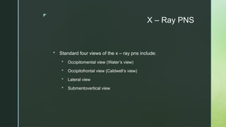 X ray Paranasal sinuses? PNS............ | PPTX