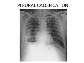 xray of chest abdomen X-ray of headppt.pdf