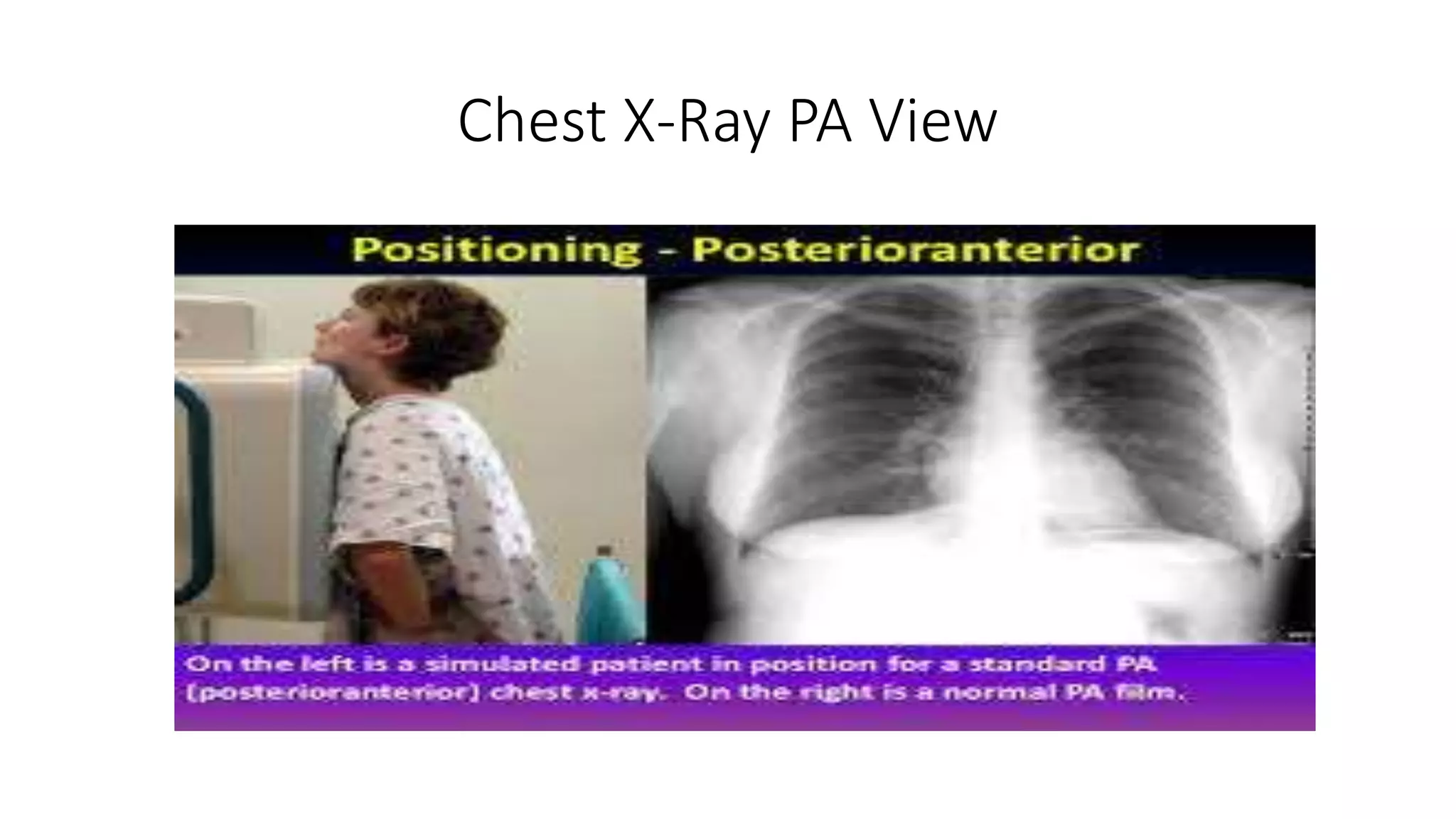 X RAY PRESENTATION.pptx