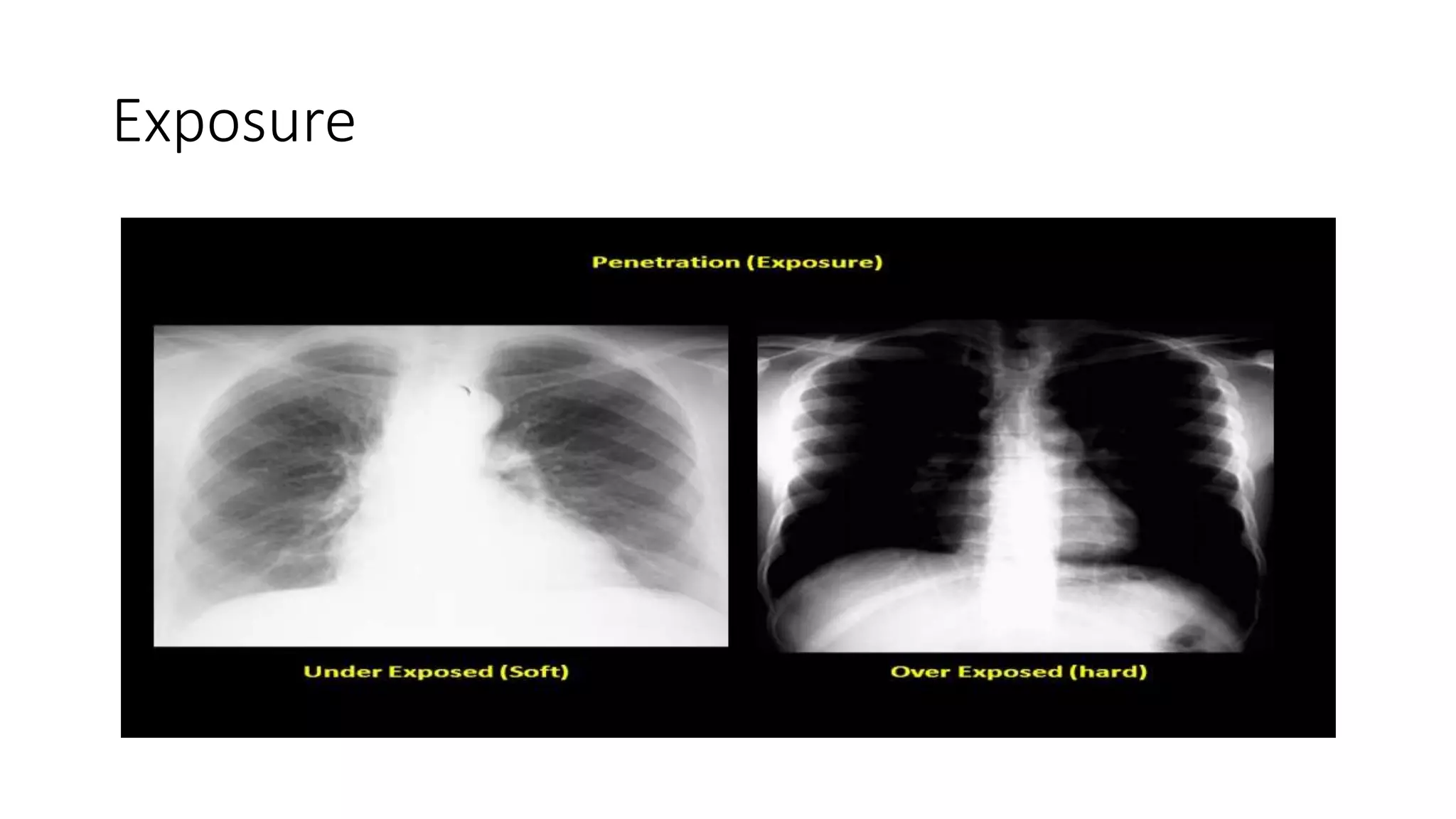 X RAY PRESENTATION.pptx