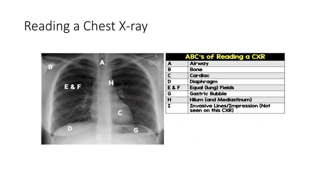 X RAY PRESENTATION.pptx