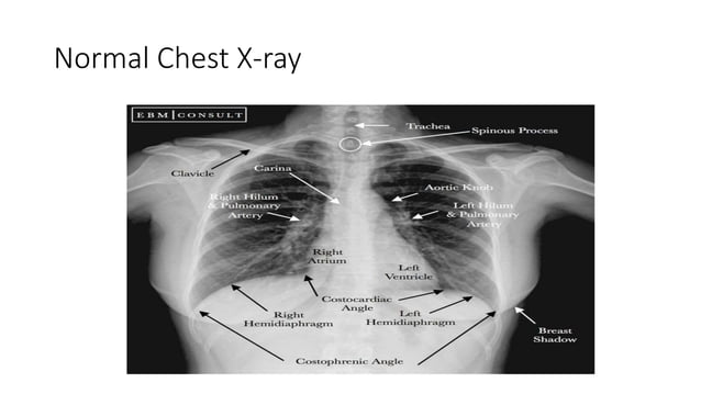 X RAY PRESENTATION.pptx