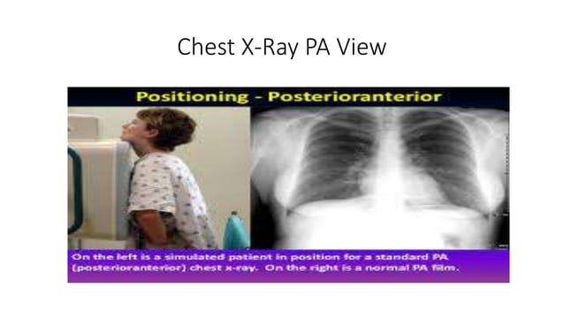 X RAY PRESENTATION.pptx