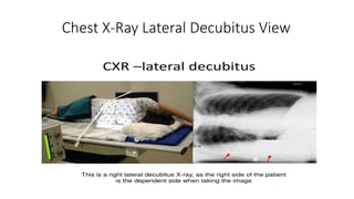 X RAY PRESENTATION.pptx