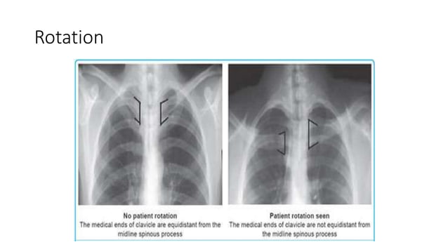 X RAY PRESENTATION.pptx