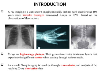 X-RAY PRODUCTION IN THE FIELD OF RADIOLOGY | PPTX