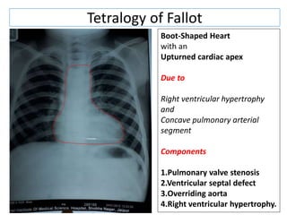 X rays in pediatrics | PPTX
