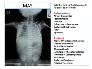 X rays in pediatrics | PPTX