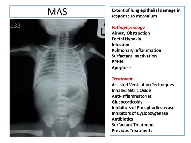 X rays in pediatrics | PPTX | Heart and Cardiovascular Diseases ...