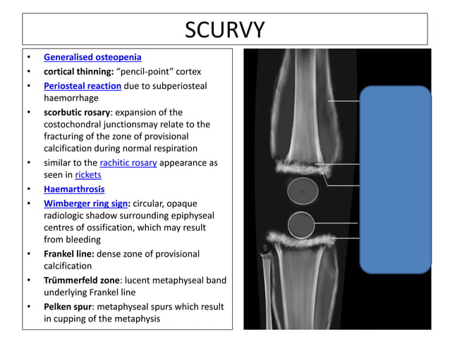 X rays in pediatrics | PPTX | Heart and Cardiovascular Diseases | Diseases and Conditions
