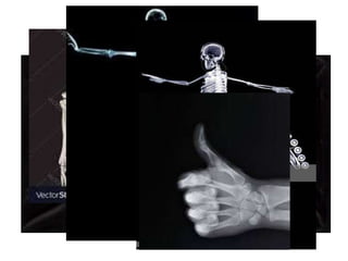 Cool X Ray Pictures