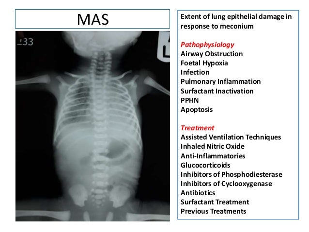 X rays in pediatrics