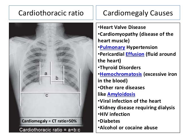 X rays in pediatrics