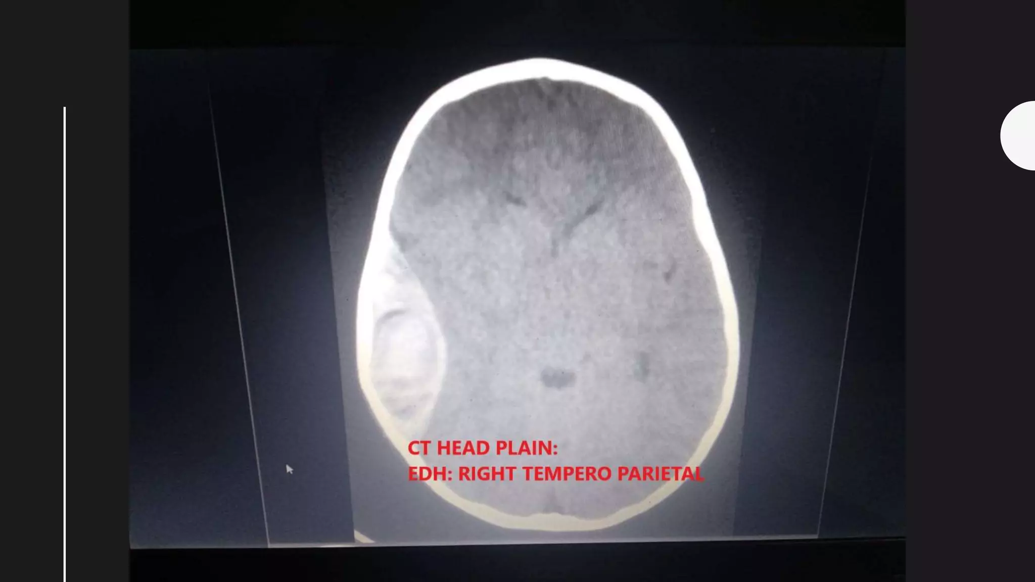 SURGICAL RADIOLOGY | PPTX