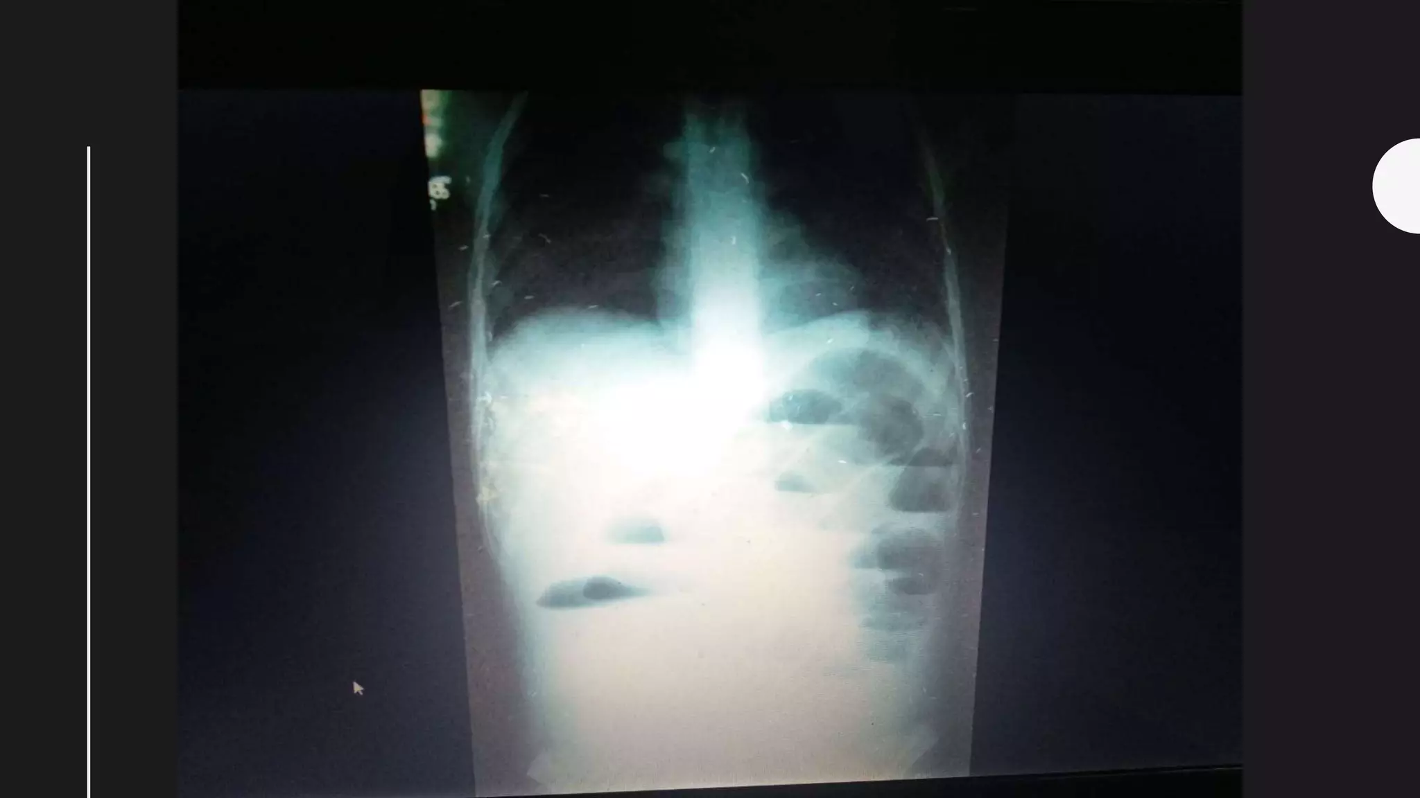 SURGICAL RADIOLOGY | PPTX