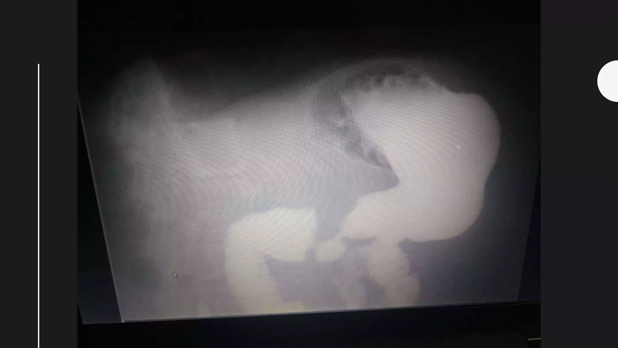 SURGICAL RADIOLOGY | PPTX