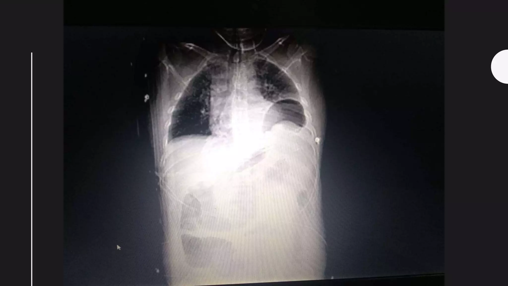 SURGICAL RADIOLOGY | PPTX