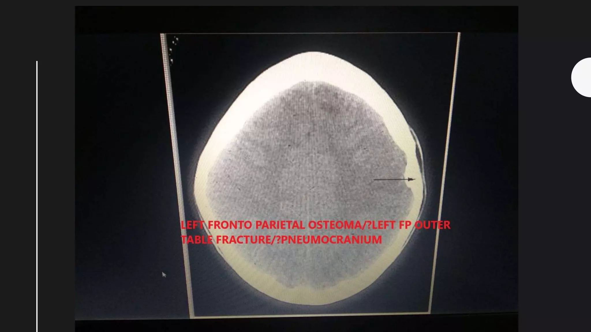 SURGICAL RADIOLOGY | PPTX