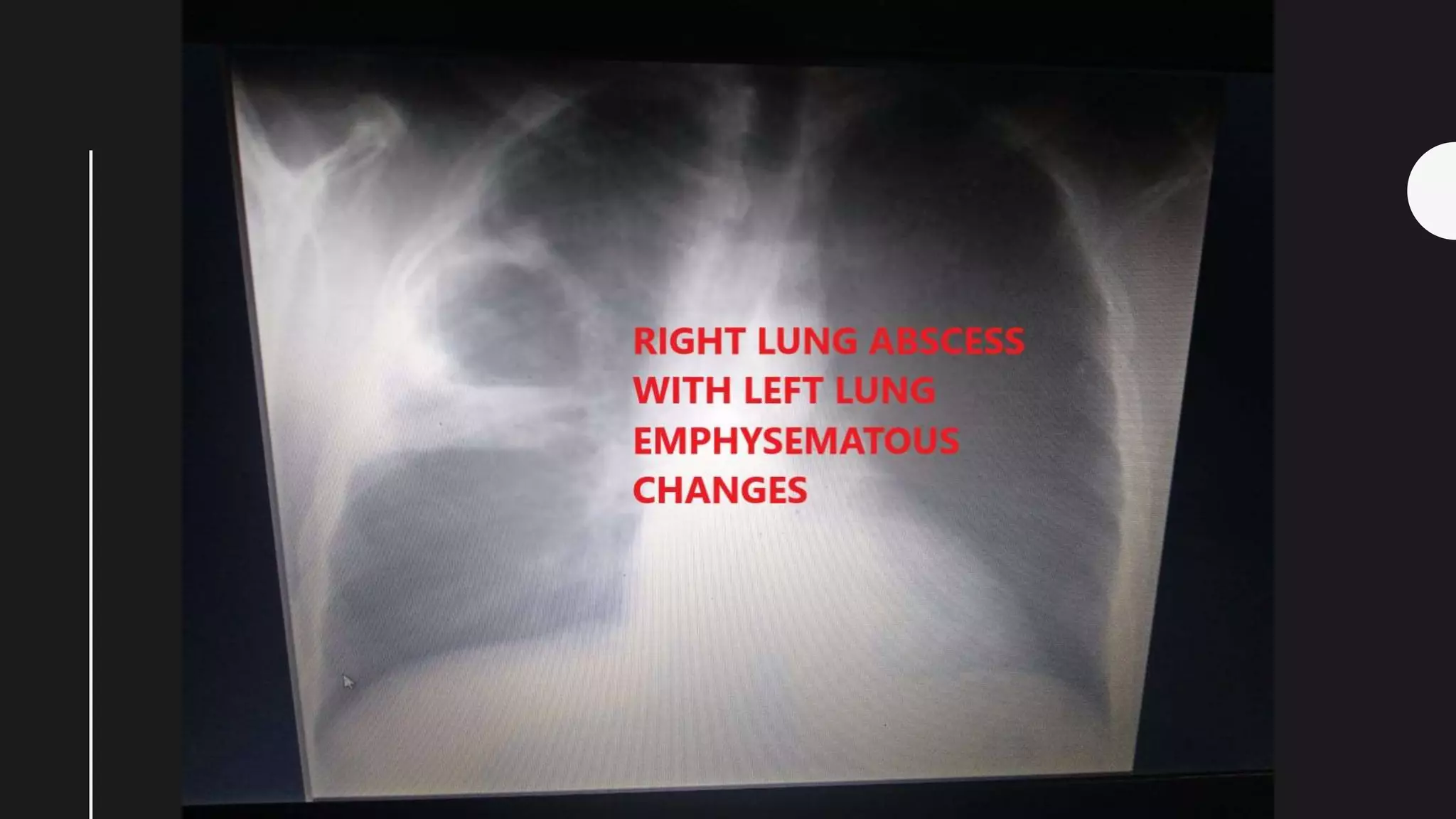 SURGICAL RADIOLOGY | PPTX