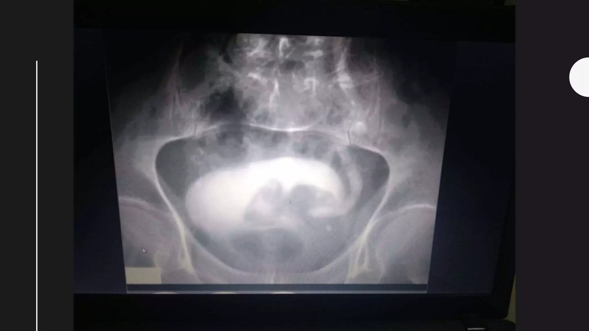 SURGICAL RADIOLOGY | PPTX