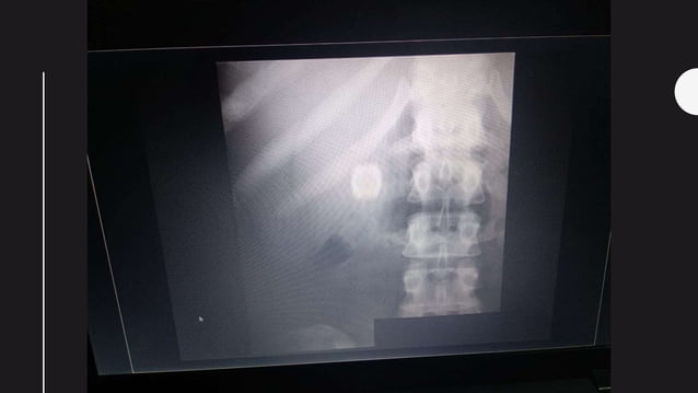 SURGICAL RADIOLOGY | PPTX