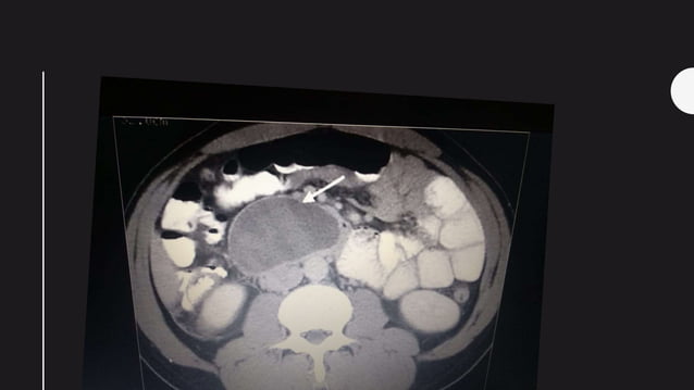 SURGICAL RADIOLOGY | PPTX