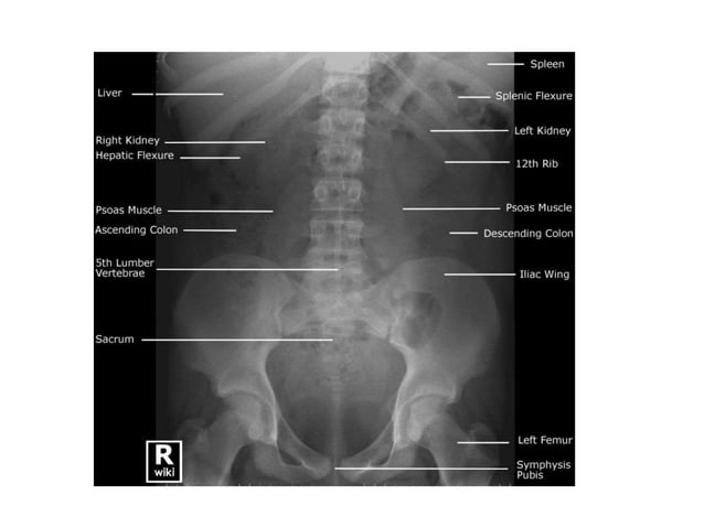 xrays-210903073920.pdf