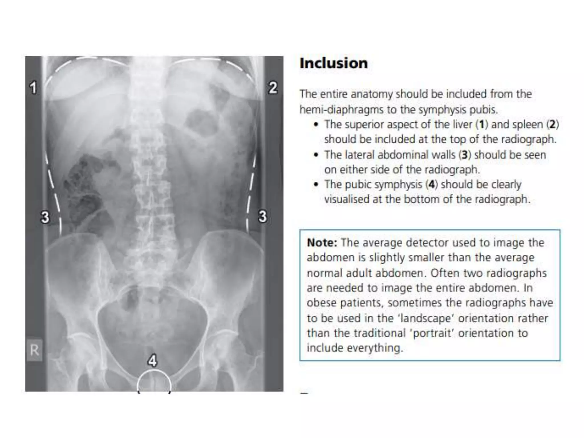 X Rays: chest injury, abdomen- bowel obstruction & perforation, KUB ...