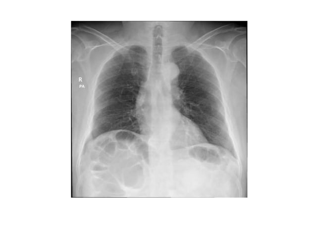 X Rays: chest injury, abdomen- bowel obstruction & perforation, KUB &IVP