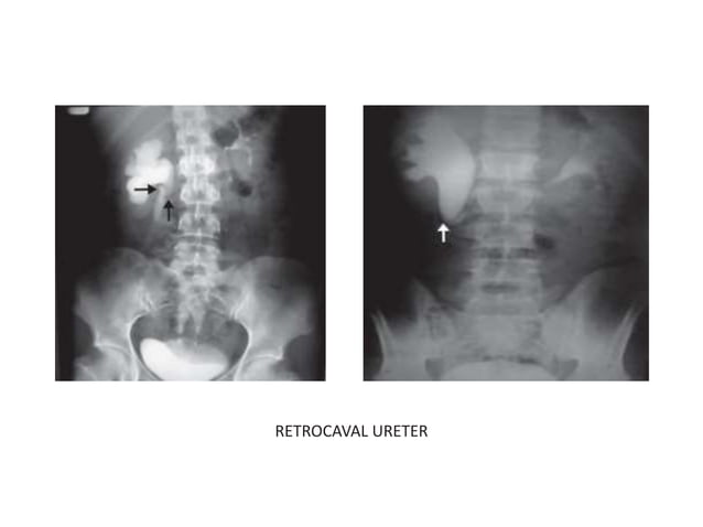 X Rays: chest injury, abdomen- bowel obstruction & perforation, KUB &IVP