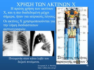 X_rays.ppsx