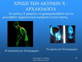 X_rays.ppsx