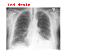 x rays.pptxhshsjsjdkdkrkrkdldlrkdkrkrkkrkr | PPT