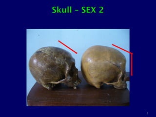X-ray identification of bones for forensic | PDF