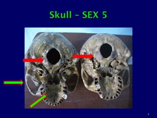 X-ray identification of bones for forensic | PDF