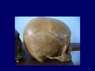 X-ray identification of bones for forensic | PDF