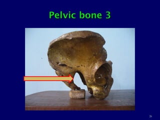 X-ray identification of bones for forensic | PDF