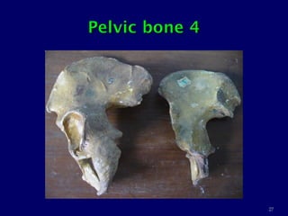 X-ray identification of bones for forensic | PDF